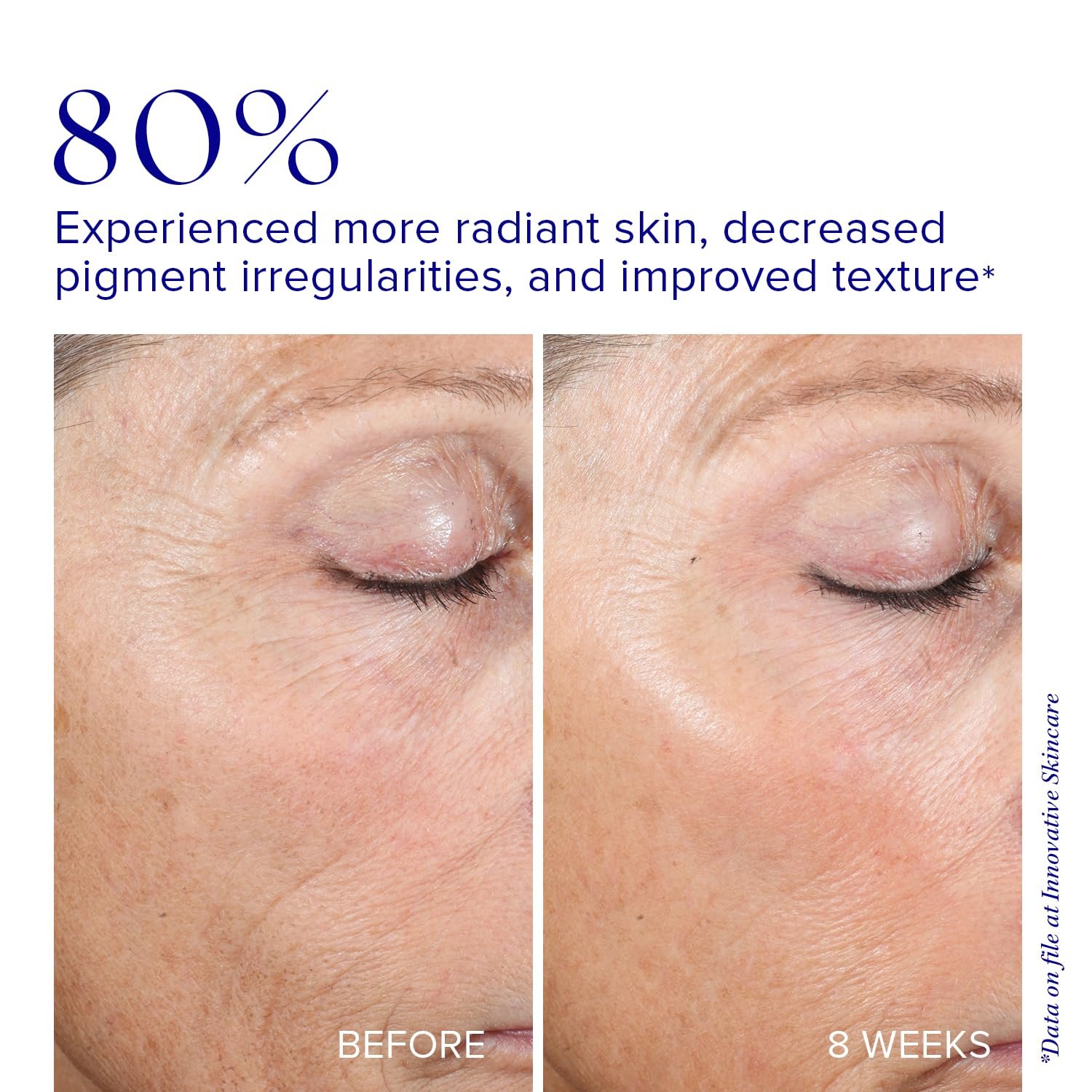 iS Clinical Active Peel System – Skin Atelier